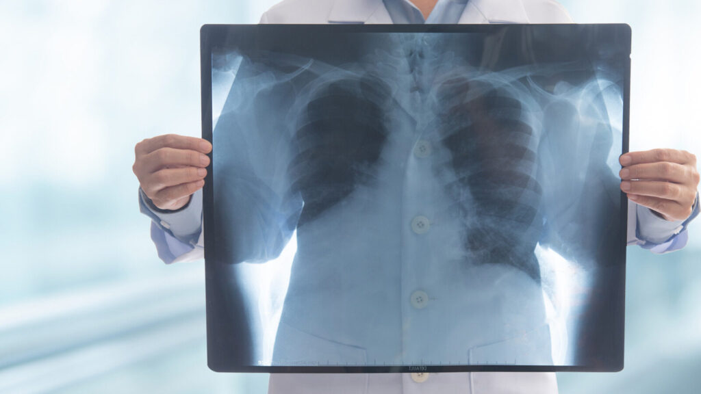 The intriguing history of the discovery of X-rays